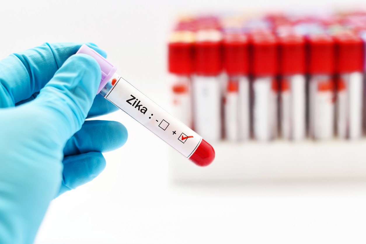 Zika Vírus: transmissão, sintomas, tratamento e prevenção